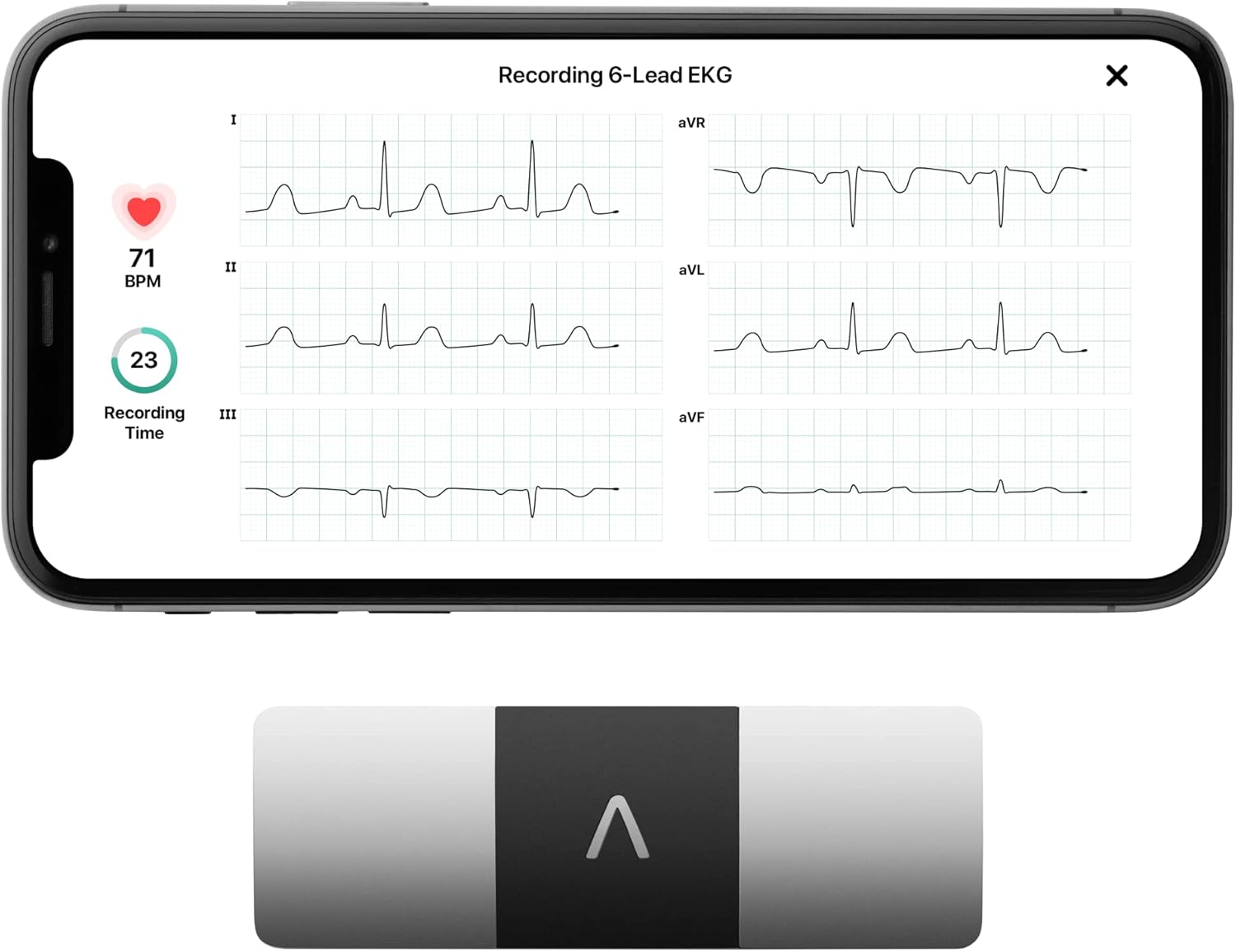 KardiaMobile 6-Lead Personal EKG Monitor Sale $99.00 - BuyVia